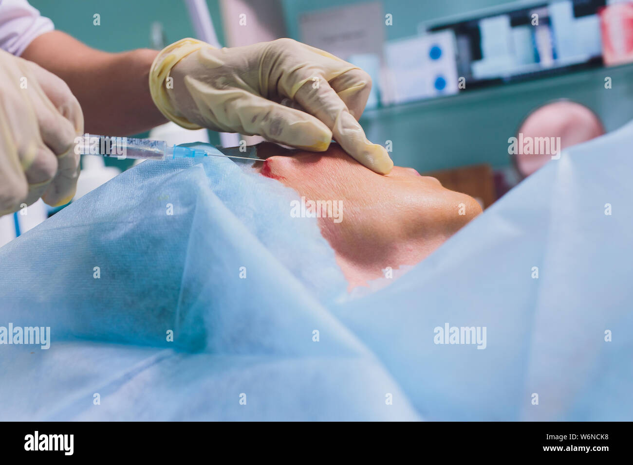 Aged woman doing mesothreads and Thread Lifting, Cosmetology. Cosmetic ...