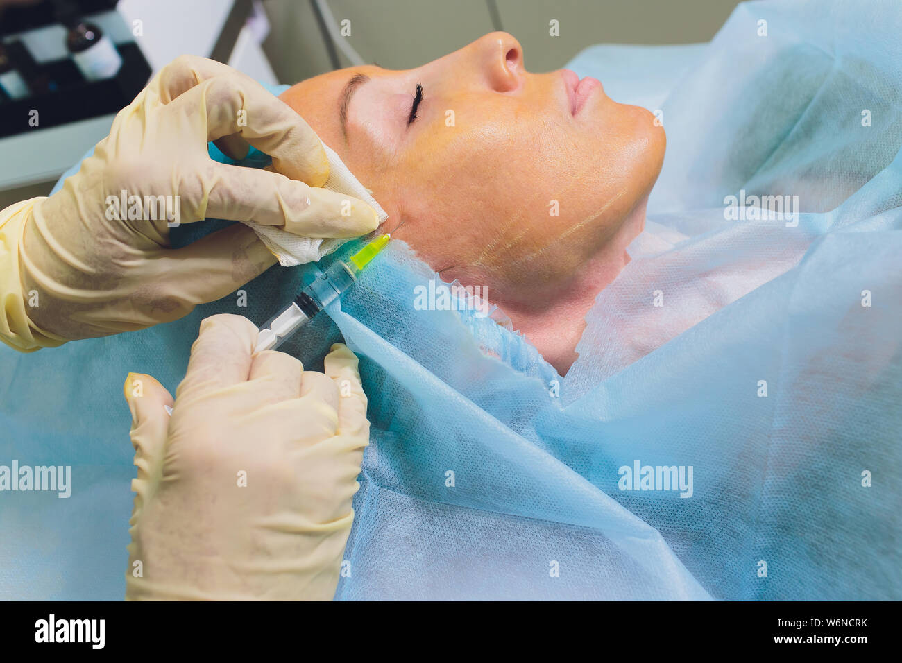 Aged woman doing mesothreads and Thread Lifting, Cosmetology. Cosmetic ...