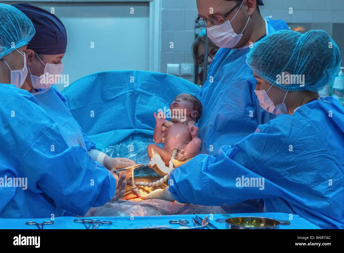 New life, baby being born via Caesarean Section in the operating room ...