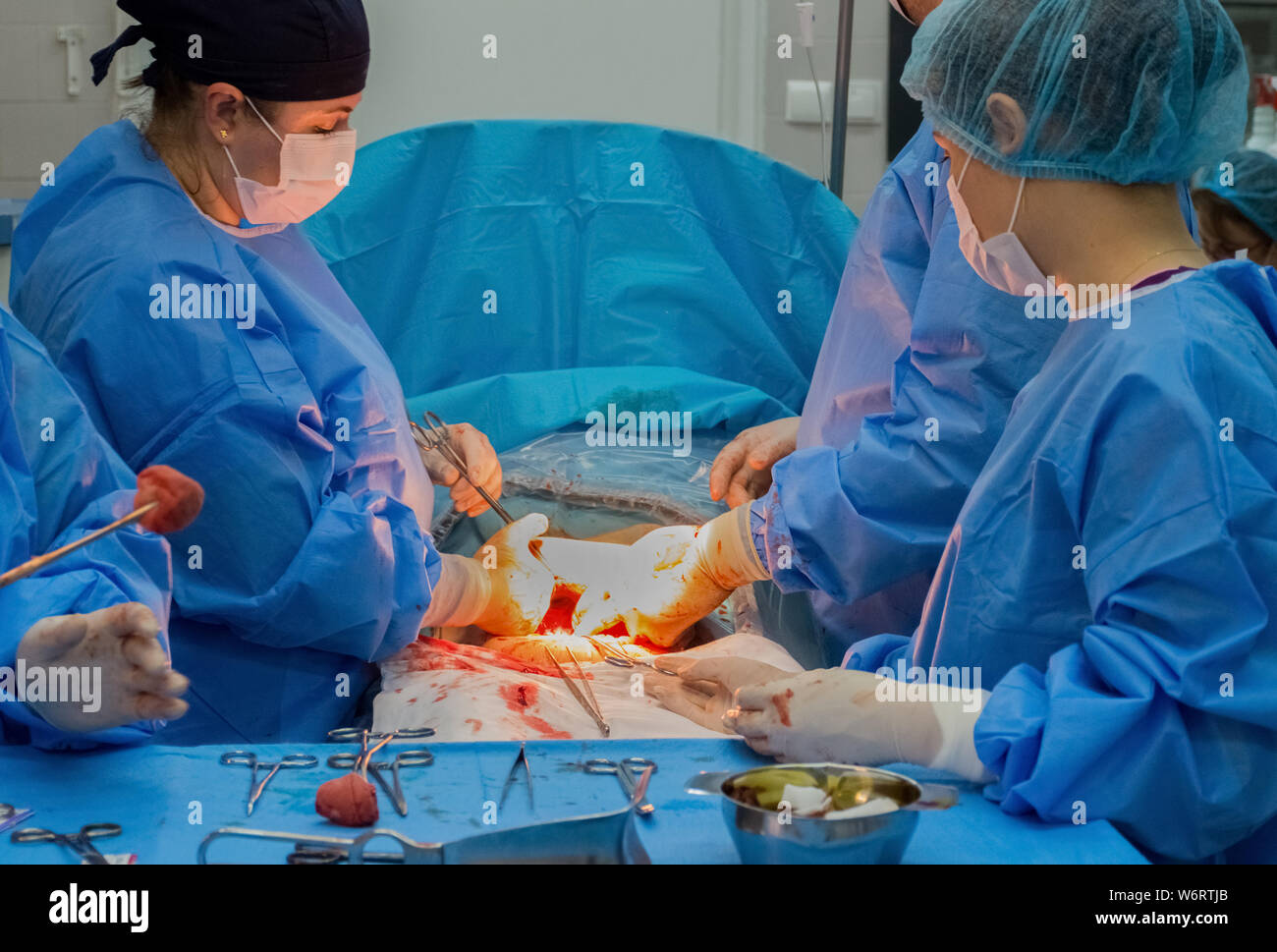 Doctor surgery team in the operating room of abdominal cesarean section ...