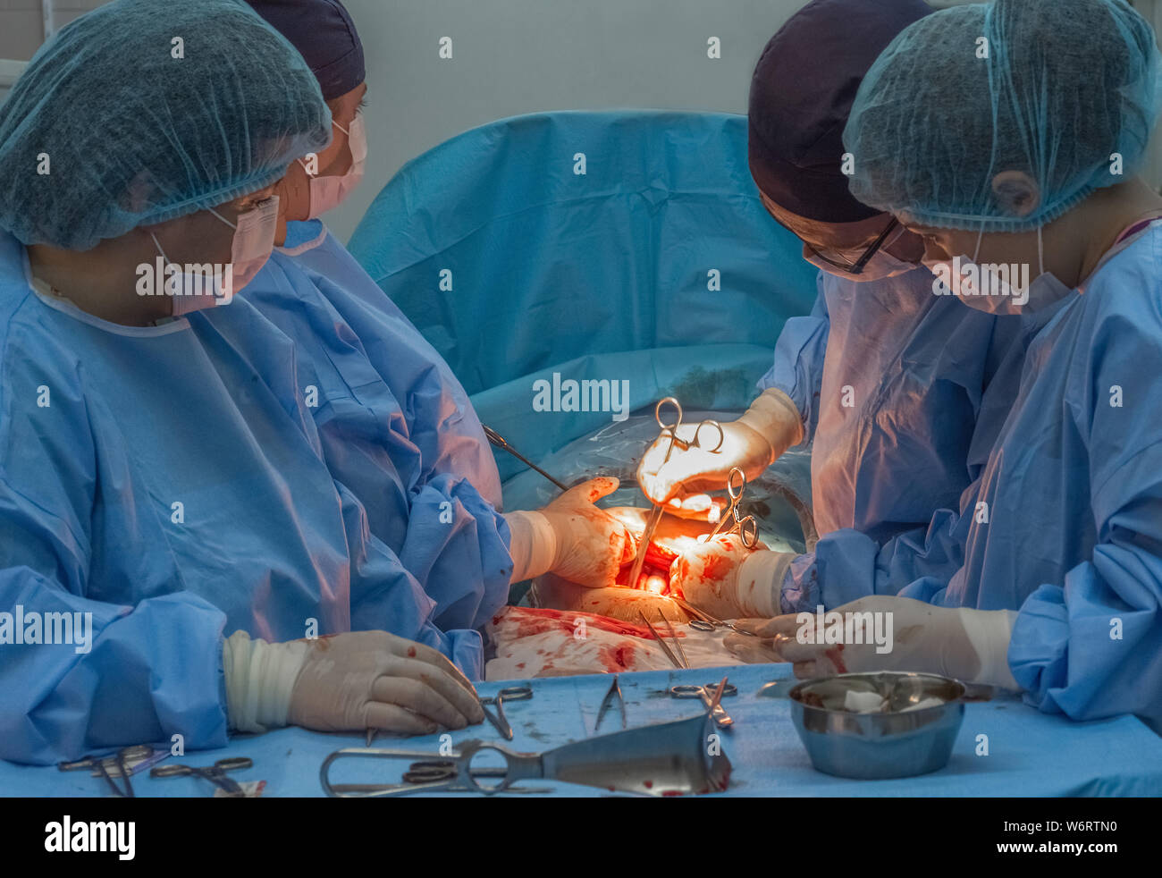 Doctor surgery team in the operating room of abdominal cesarean section ...