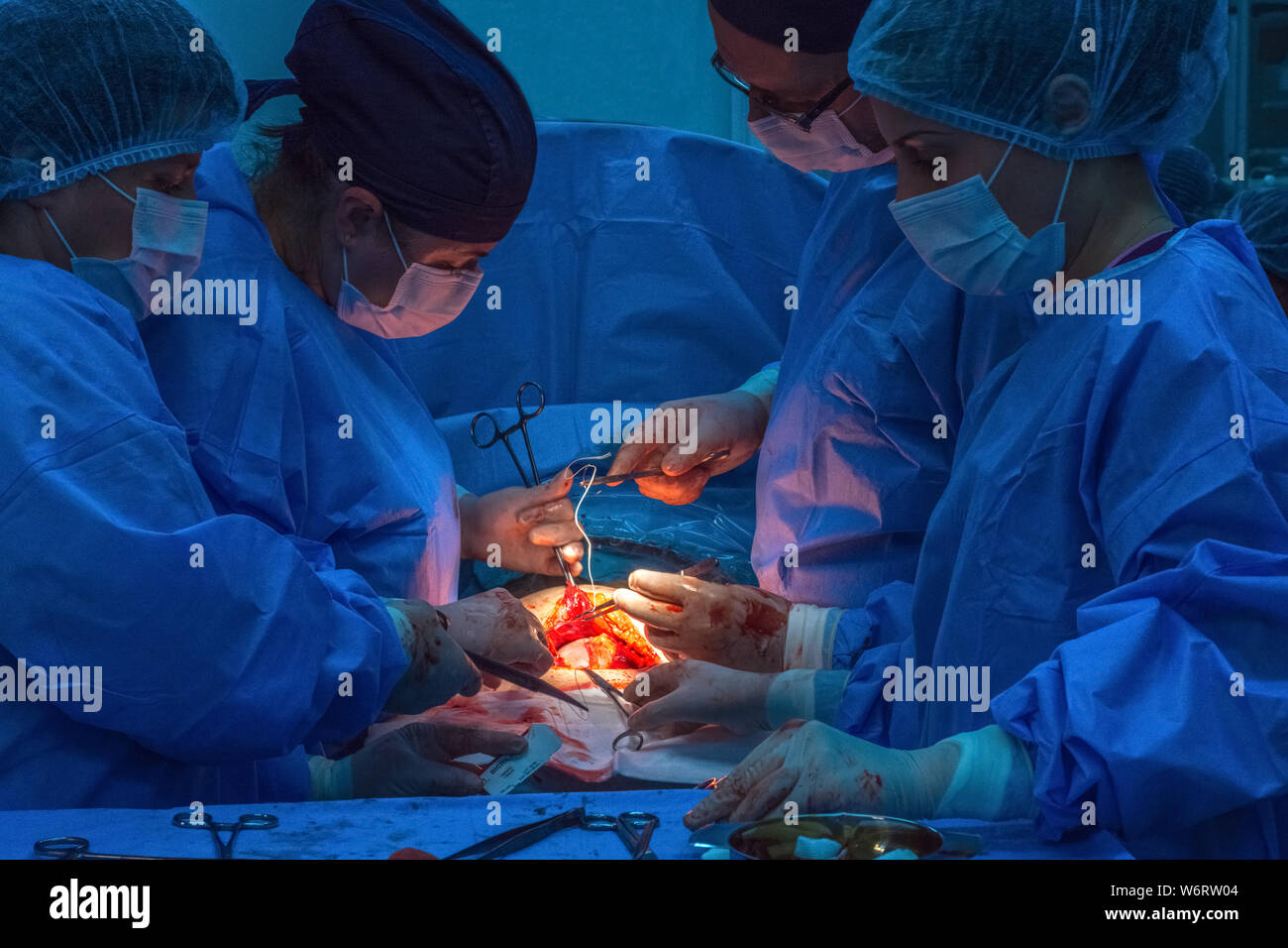 Doctor surgery team in the operating room of abdominal cesarean section ...