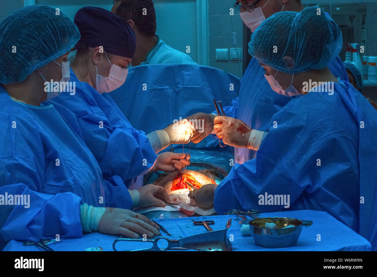 Mother during cesarean birth hi-res stock photography and images - Alamy