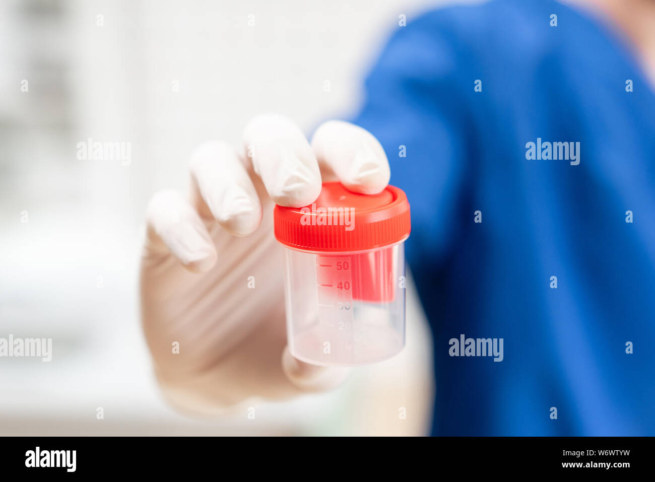Doctor in blue uniform and medical gloves holding a container for semen ...