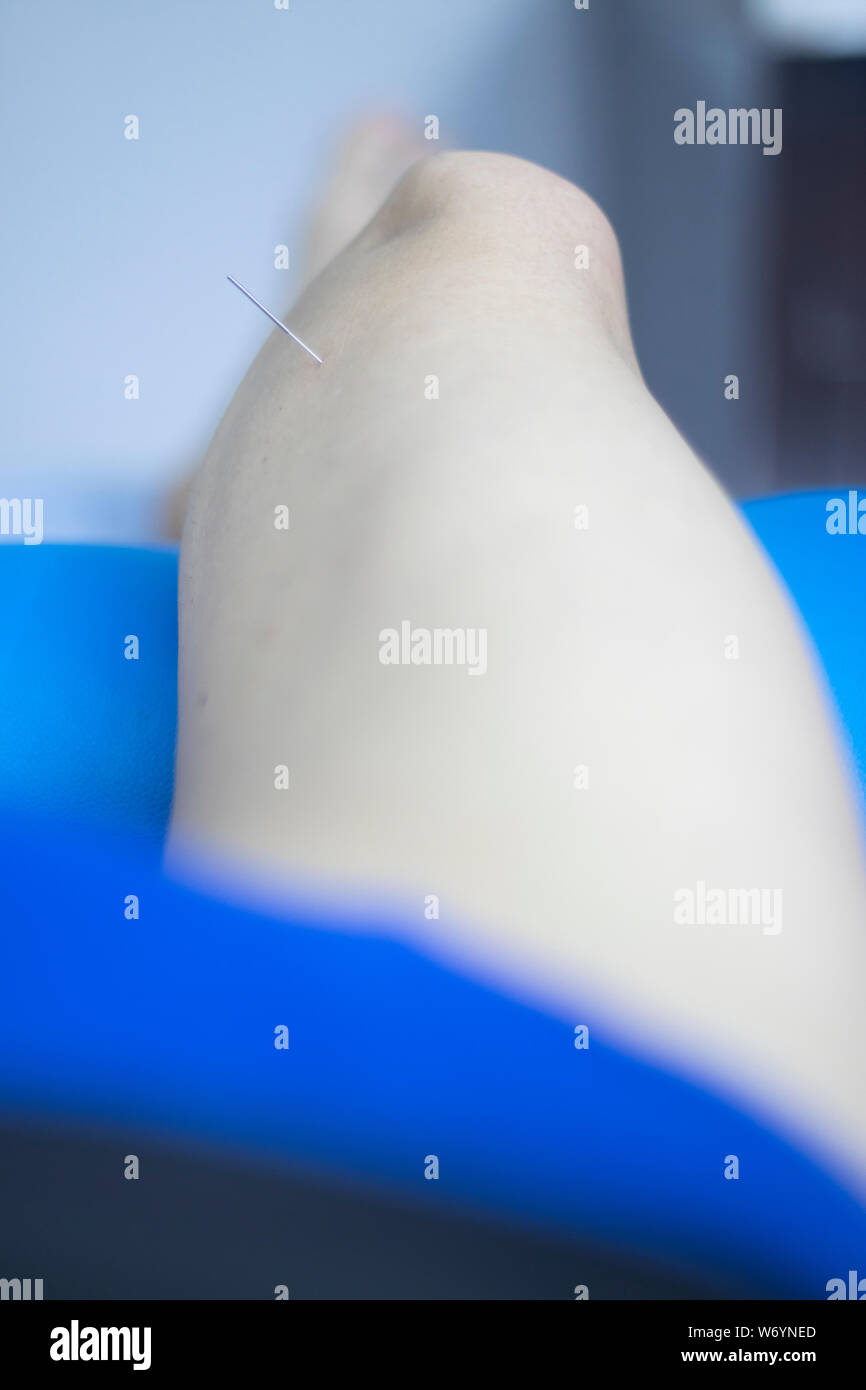 EPI Intratissue Percutaneous Electrolysis dry needling ultrasound ...