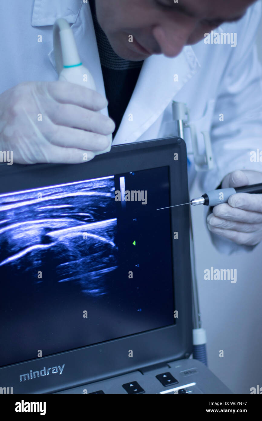 EPI Intratissue Percutaneous Electrolysis dry needling ultrasound ...