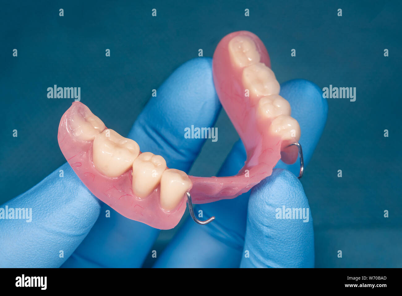 Close-up human denture of the upper jaw on a blue background in the ...