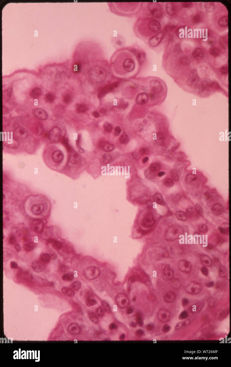 Methyl j hi-res stock photography and images - Alamy