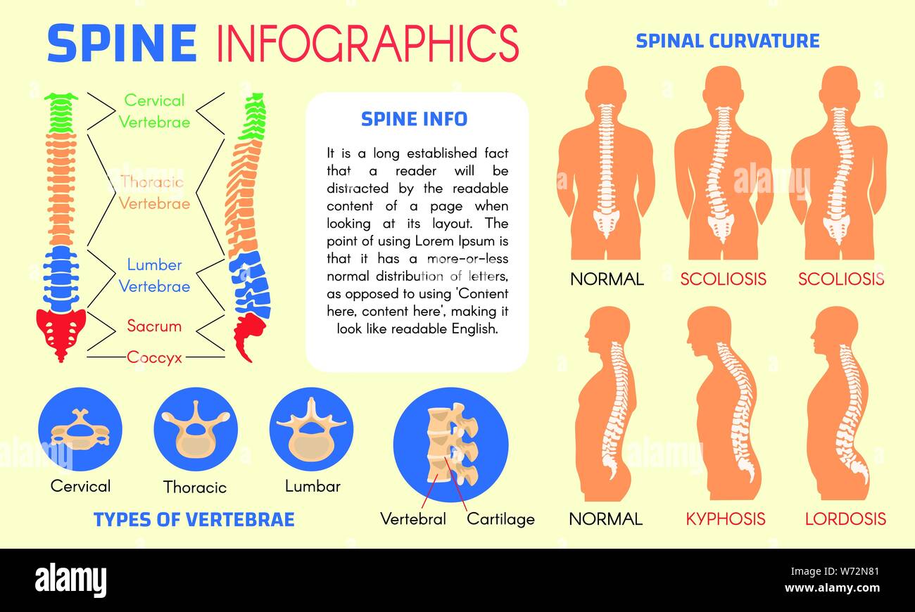 Human spine infographic. Flat illustration of human spine vector ...