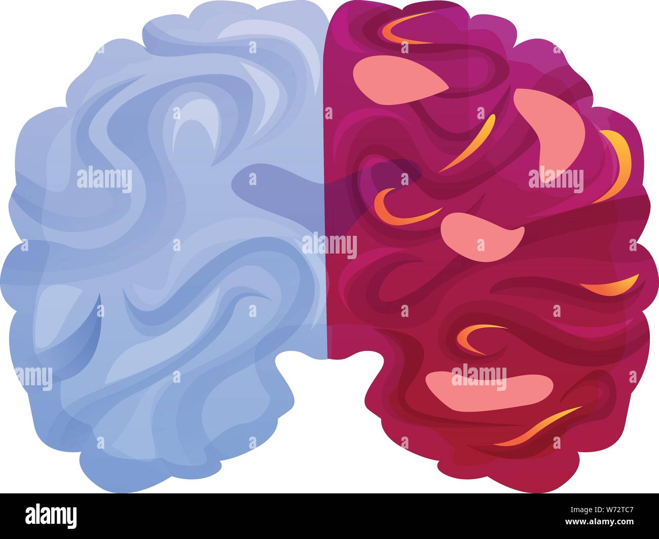 Cerebral atrophy brain Stock Vector Images - Alamy