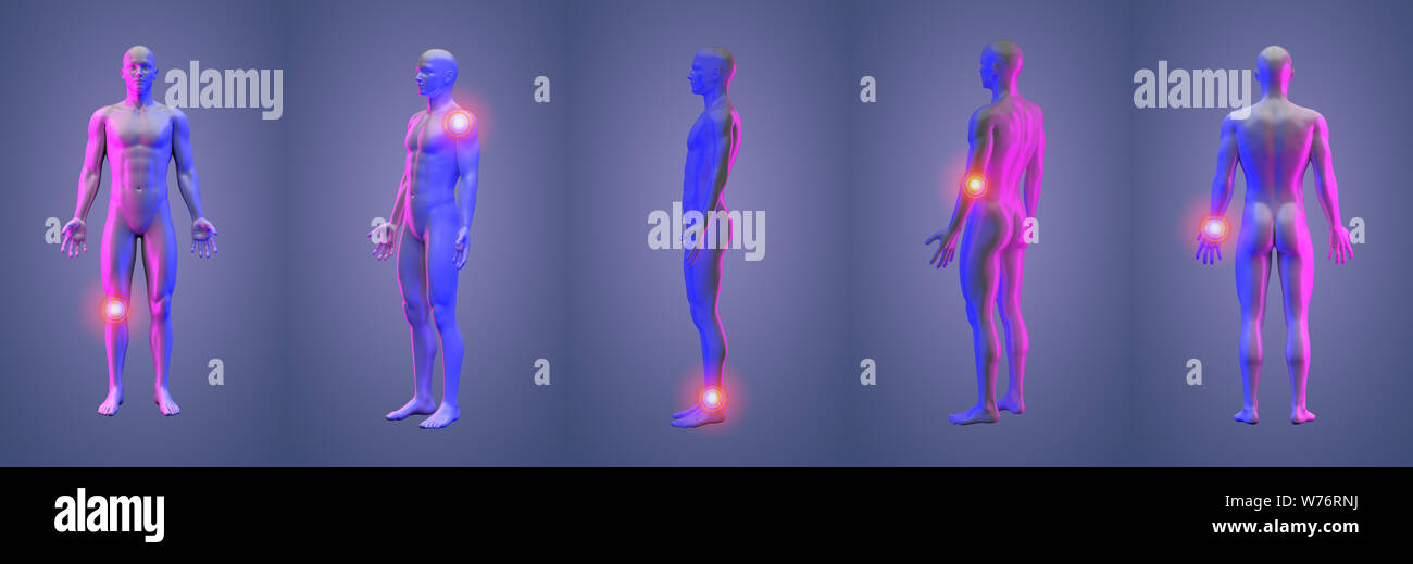 Human body pain anatomy hi-res stock photography and images - Alamy