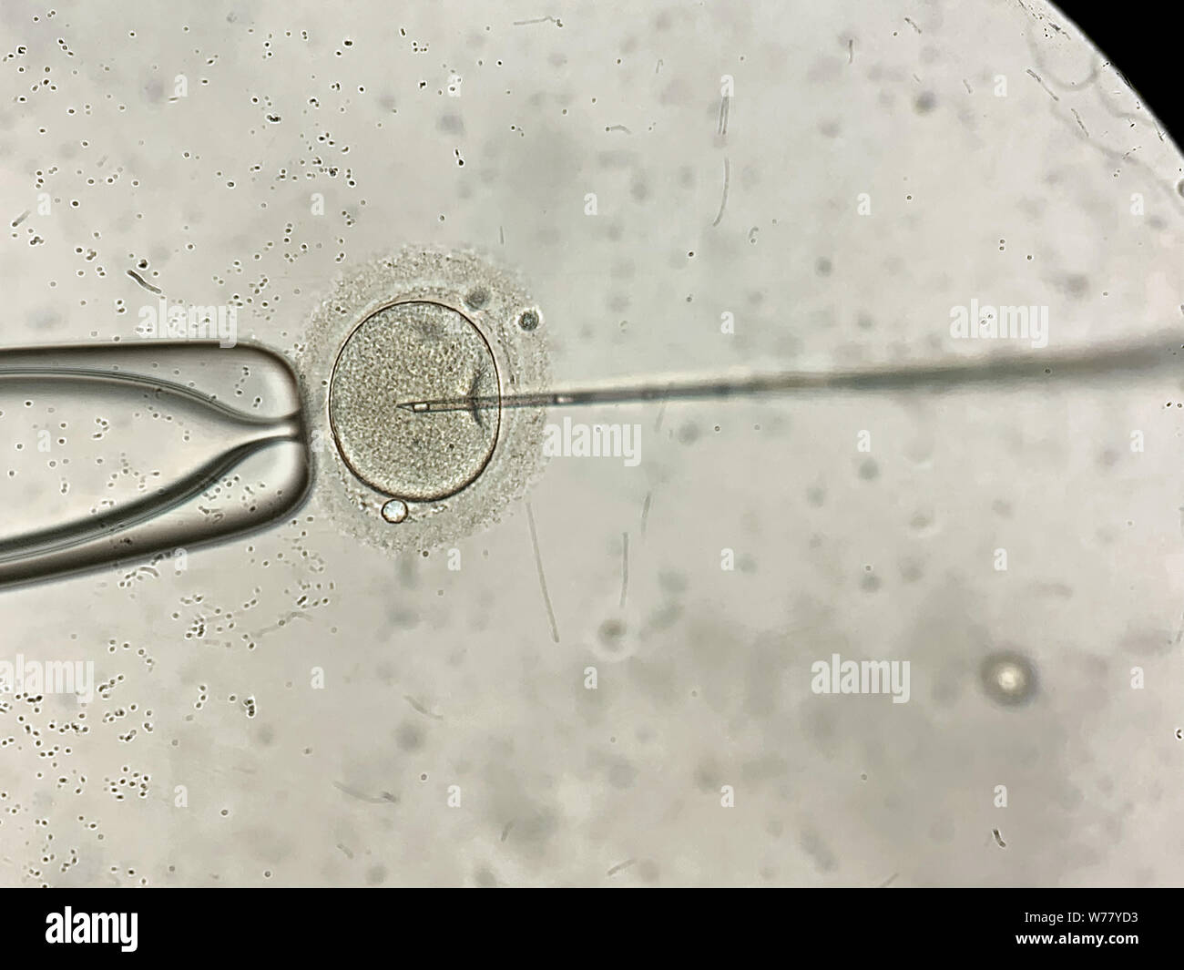 Remarkable macro view through the microscope at process of the in vitro ...