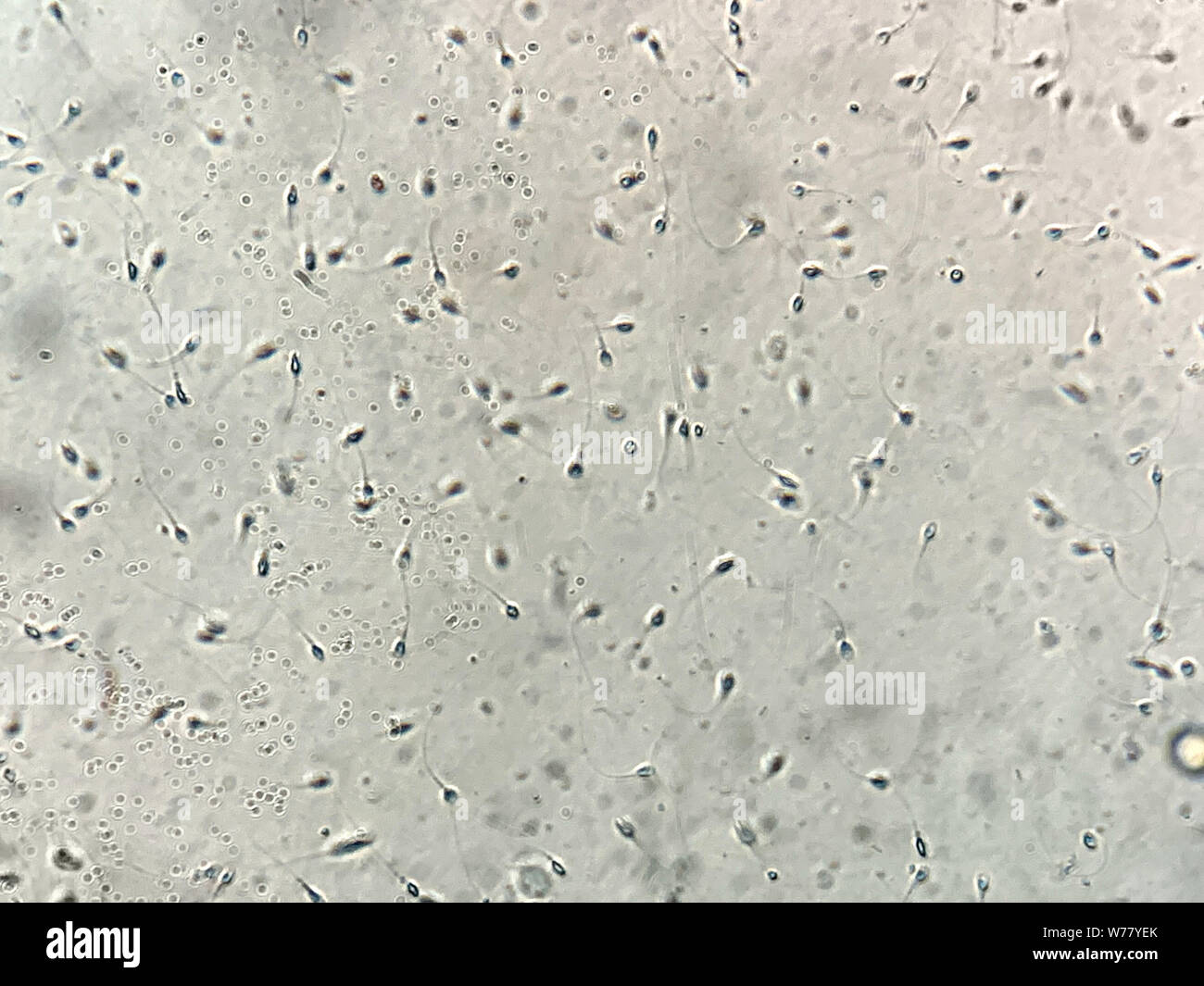 Sperm Microscope 40x