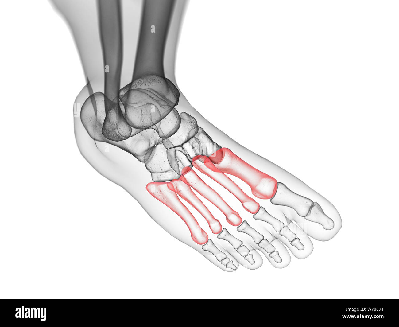 3d rendered medically accurate illustration of the metatarsal bones ...