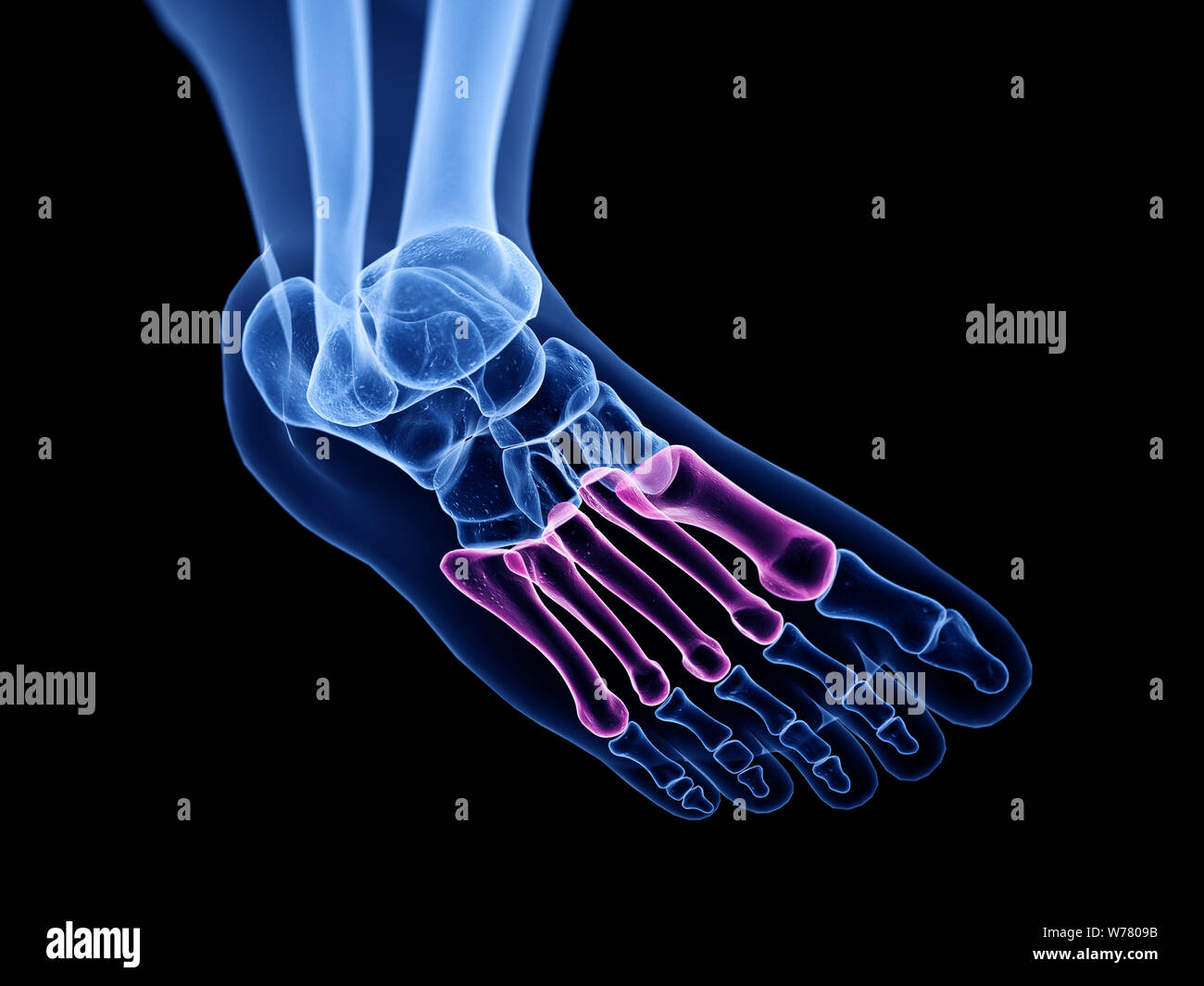 Metatarsal bones hi-res stock photography and images - Alamy