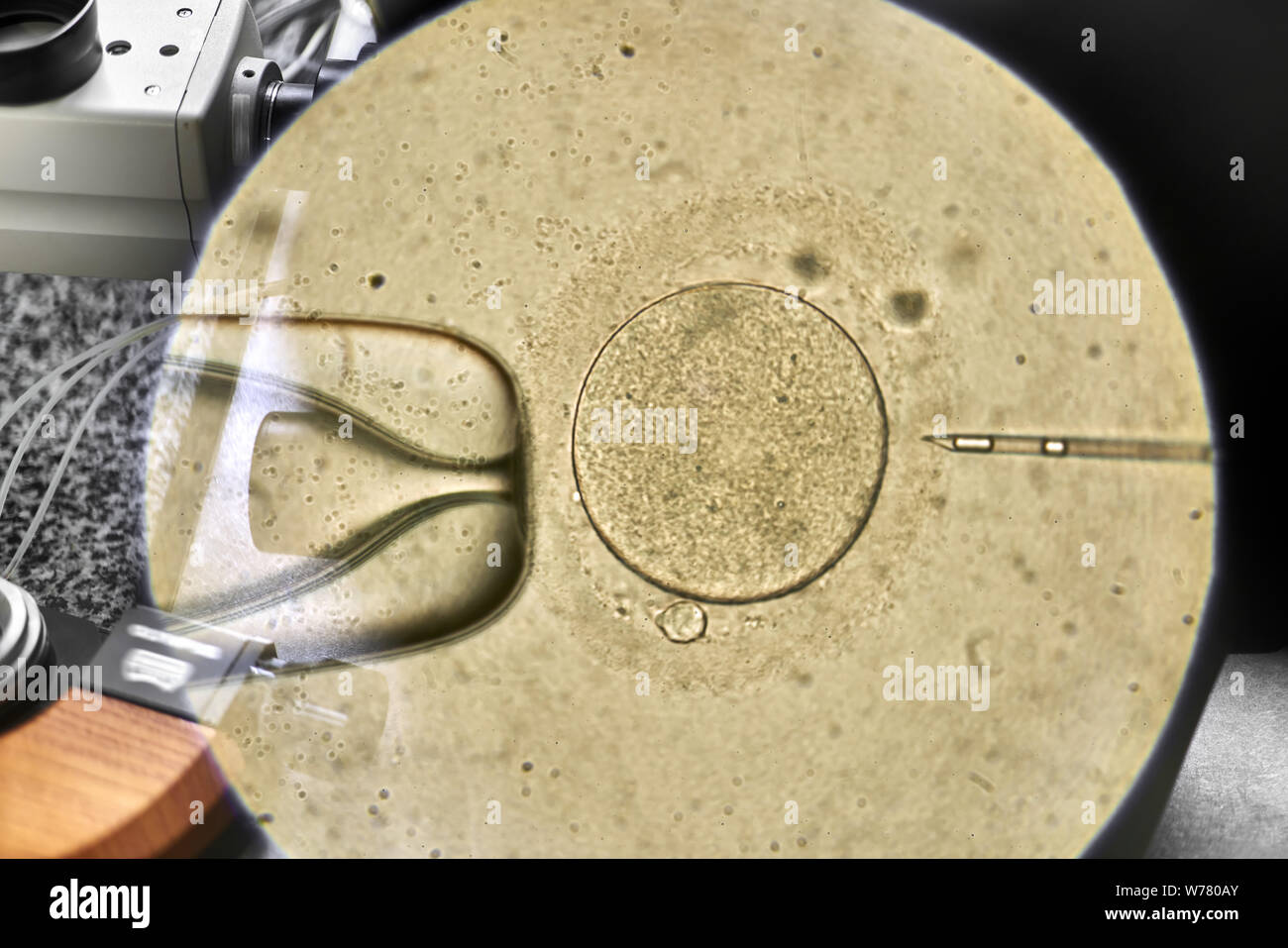 Amazing process of the in vitro fertilization of a female egg through ...