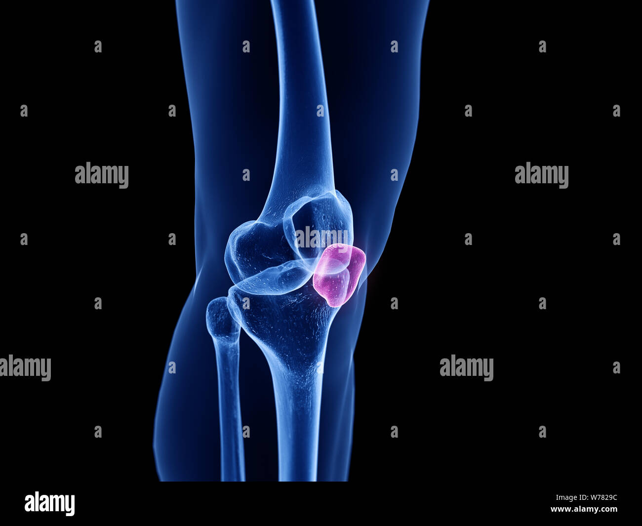 3d rendered medically accurate illustration of the patella bone Stock ...