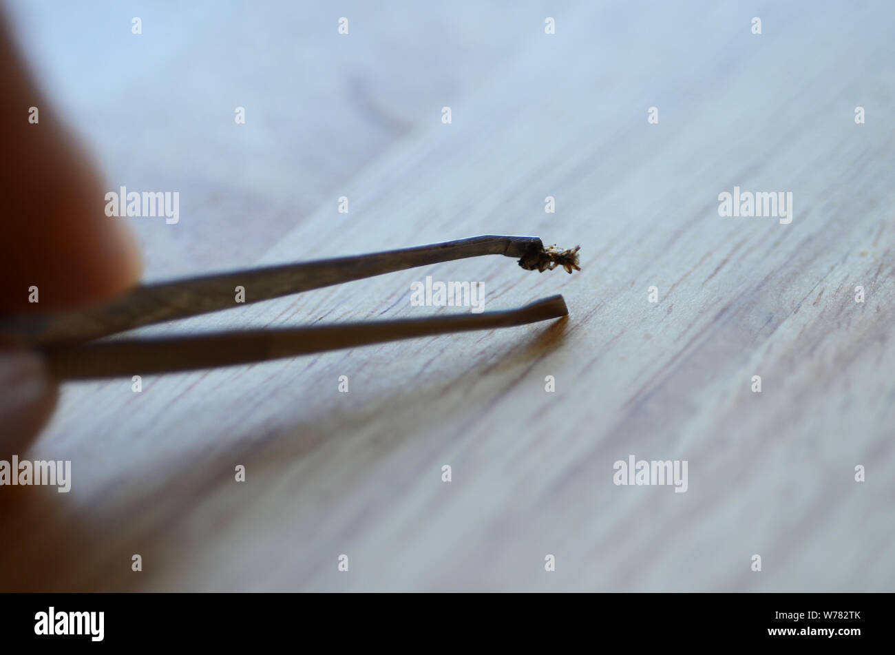 AUTOPSY ARACHNID: A thorough examination of a spiders dead body Stock ...