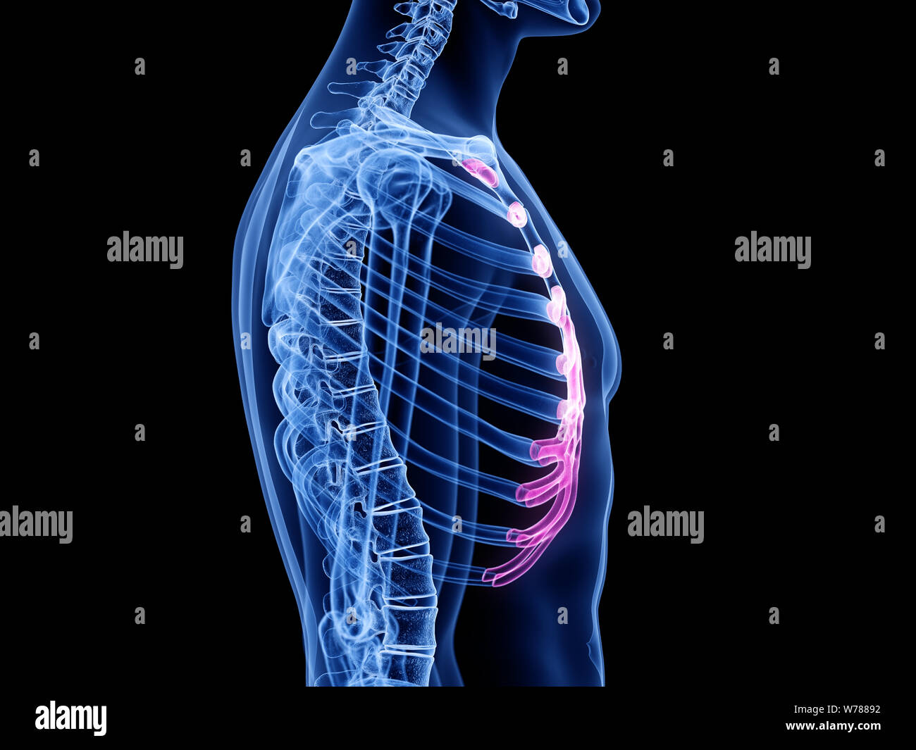 Human costal cartilage hi-res stock photography and images - Alamy