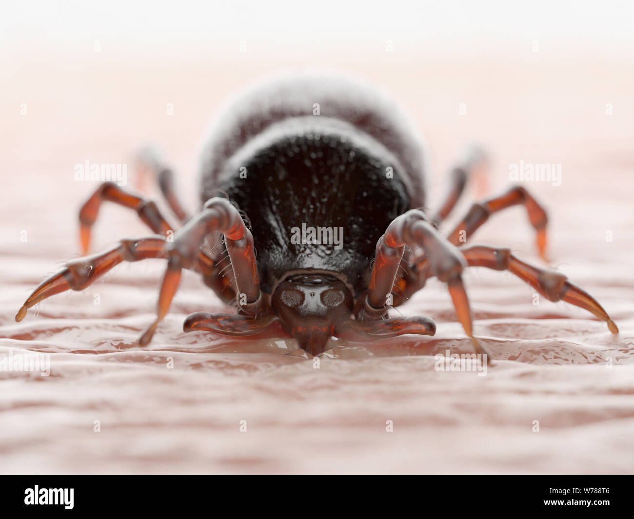 3d rendered illustration of a tick biting in human skin Stock Photo - Alamy