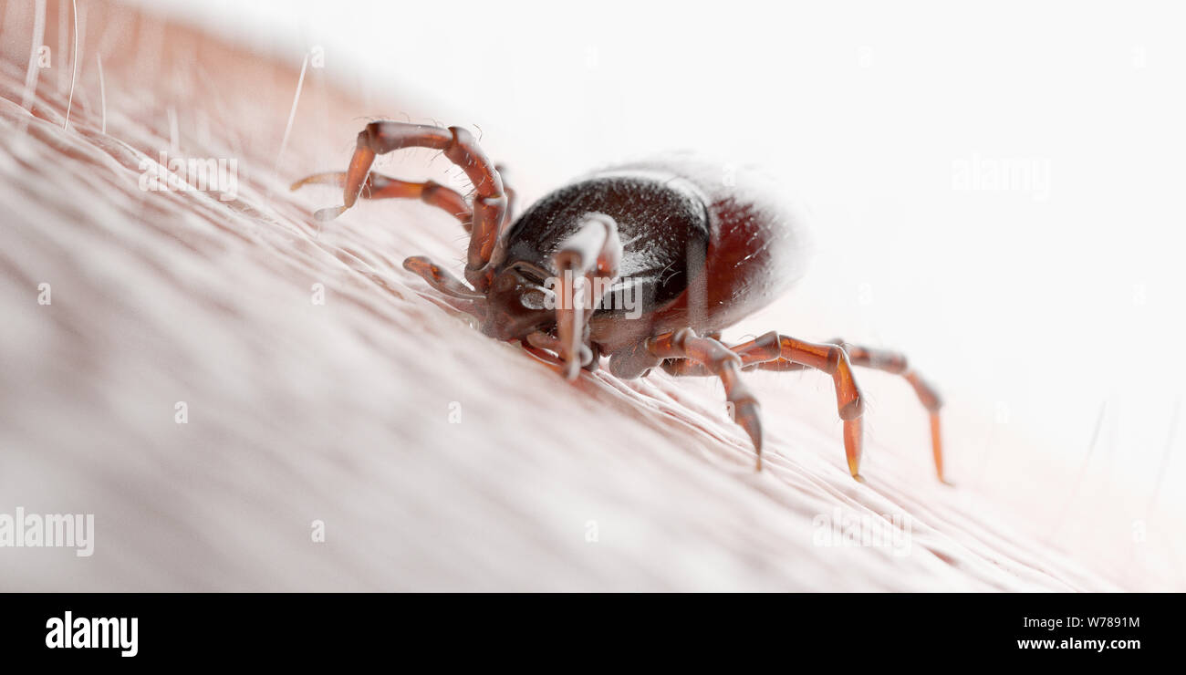 3d rendered illustration of a tick biting in human skin Stock Photo - Alamy