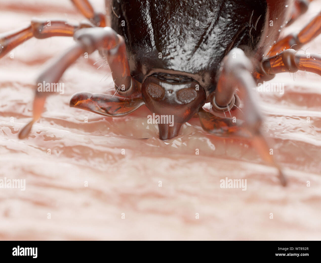 3d rendered illustration of a tick biting in human skin Stock Photo - Alamy