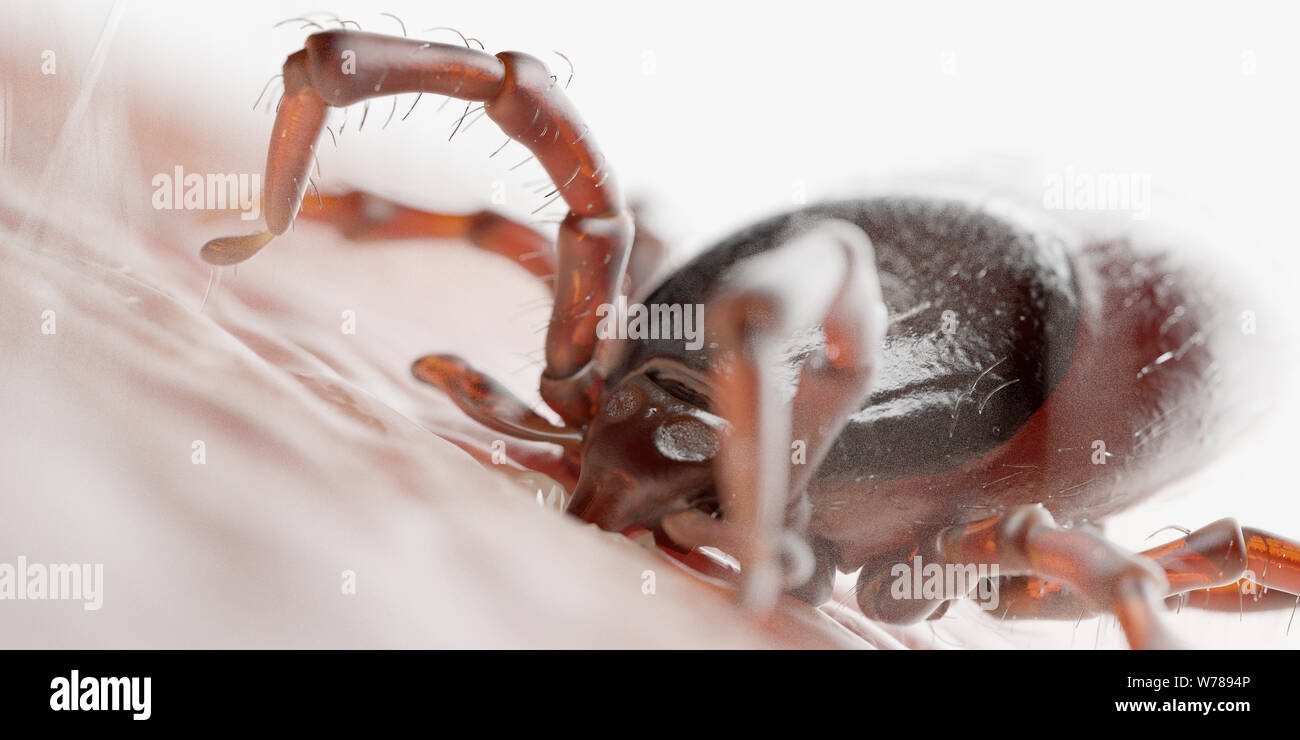 3d rendered illustration of a tick biting in human skin Stock Photo - Alamy