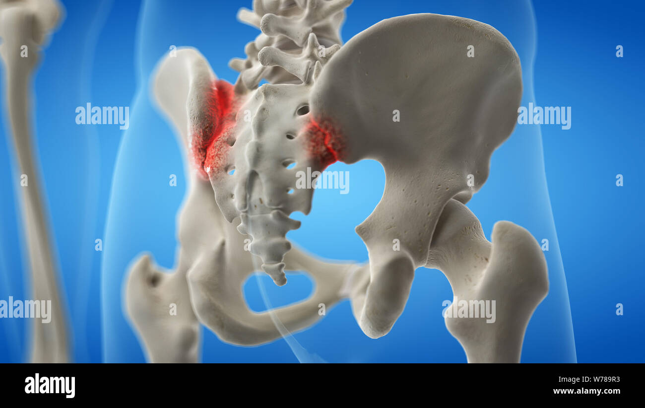 Painful sacroiliac joint hi-res stock photography and images - Alamy