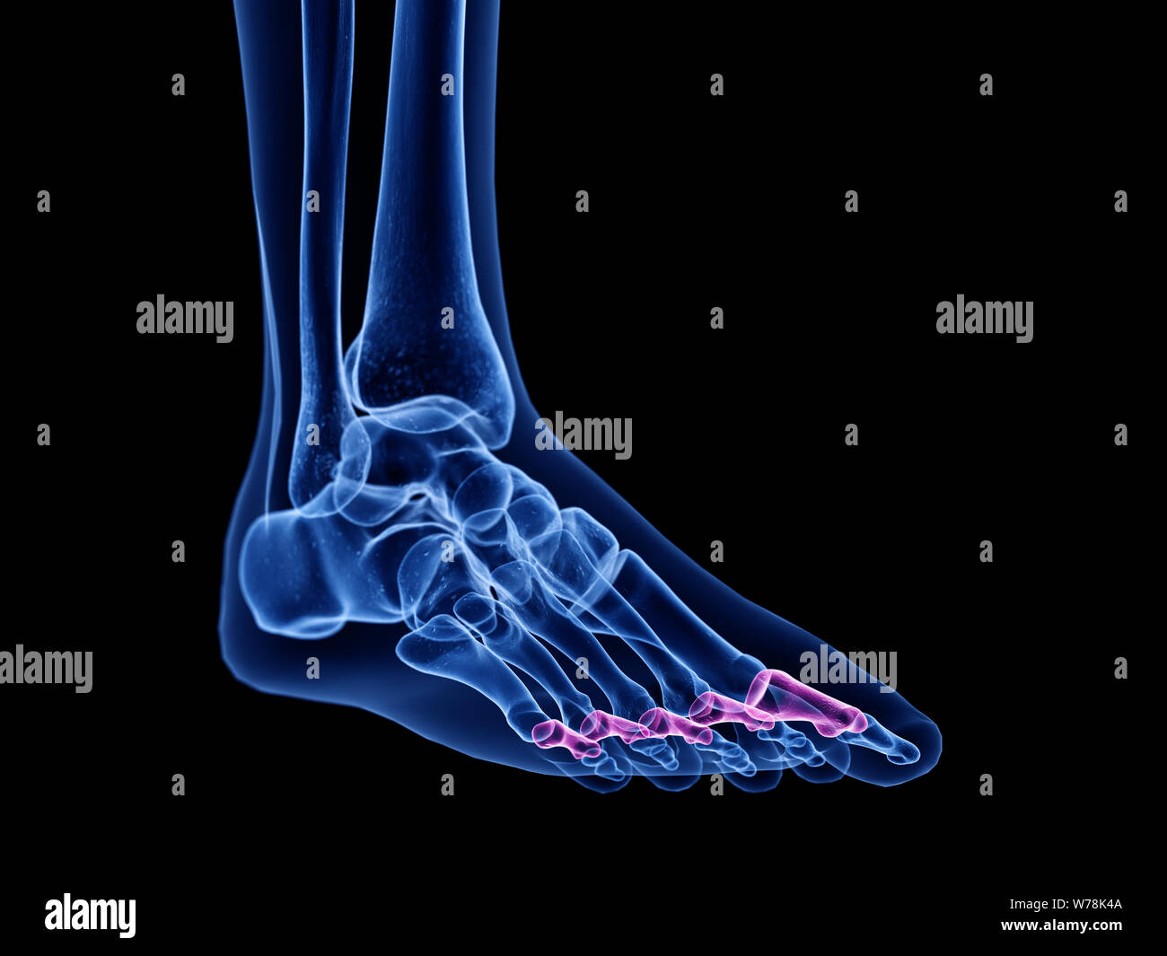 3d rendered medically accurate illustration of the proximal phalanx ...