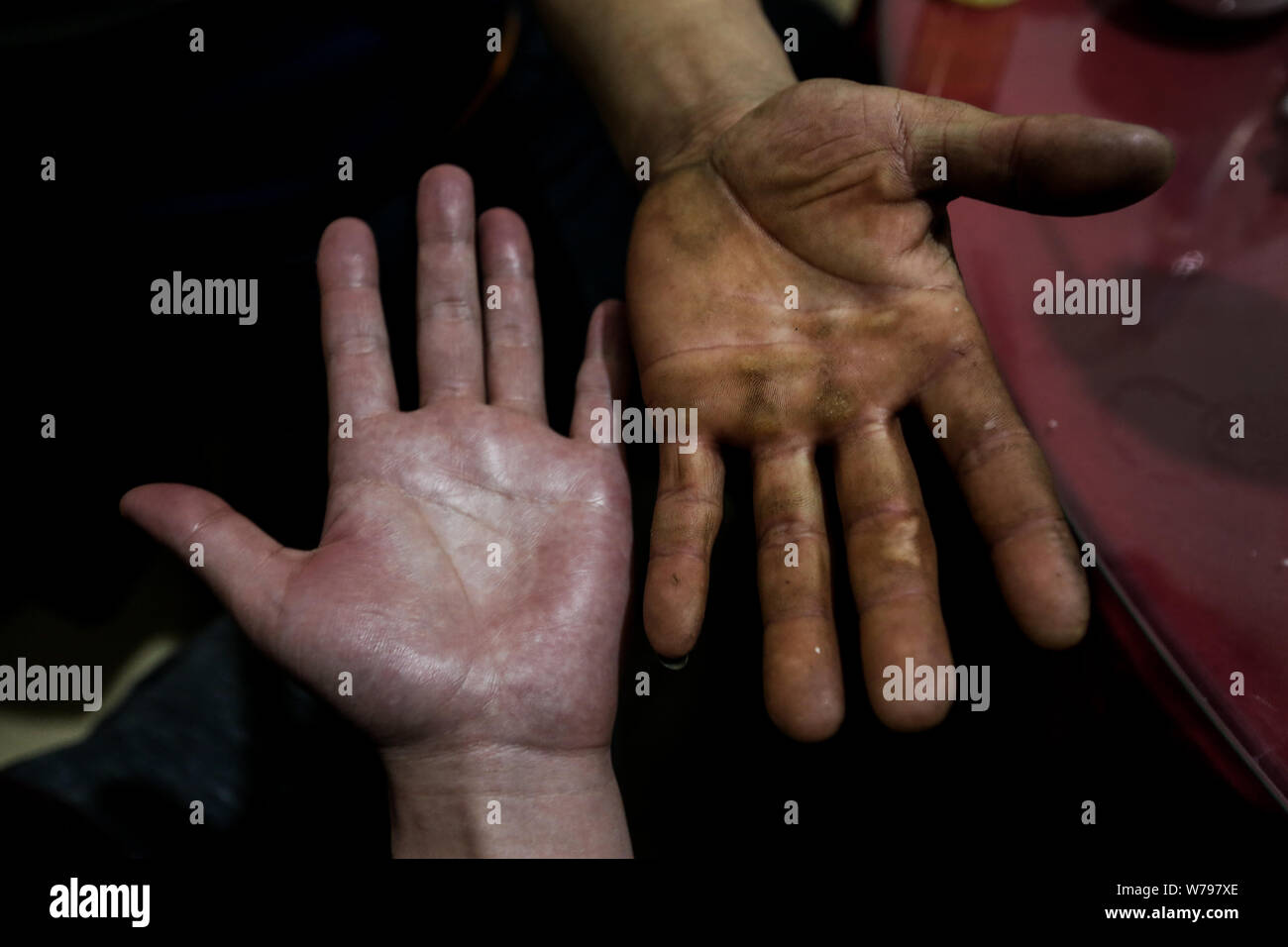 --FILE--33-year-old Chinese man Wang Liwei with one arm shows his dirty hand, right, at home in ...