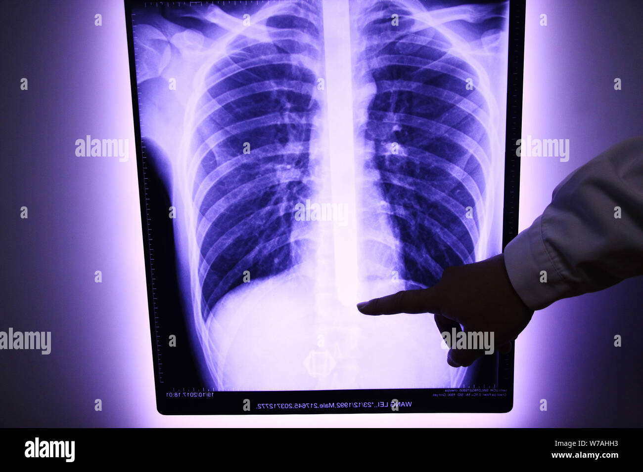 Sword swallowing hi-res stock photography and images - Alamy