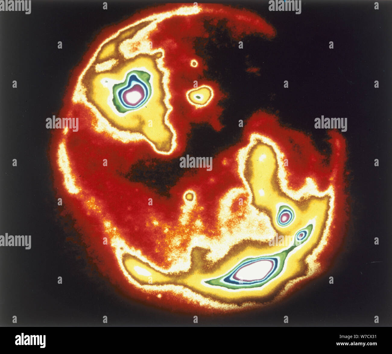 X-ray image of sun, Skylab, 1970s. Artist: Unknown Stock Photo - Alamy
