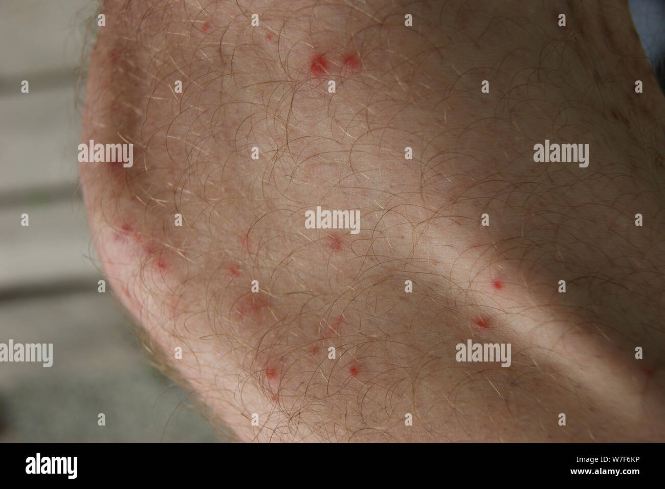 Red Leg Disease High Resolution Stock Photography and Images - Alamy