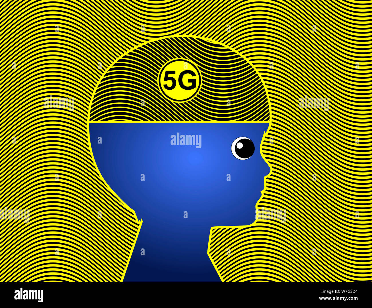 Exposed brain hi-res stock photography and images - Alamy