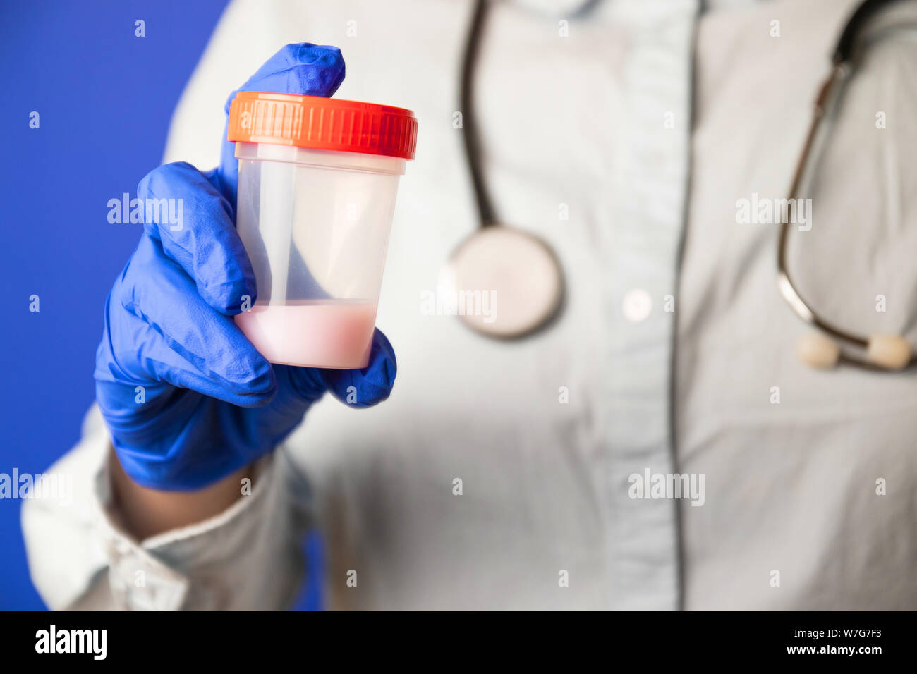 Artificial insemination. Doctor holding a plastic container with sperm ...
