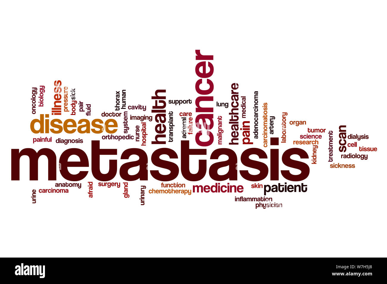 Lung metastasis, scan hi-res stock photography and images - Alamy