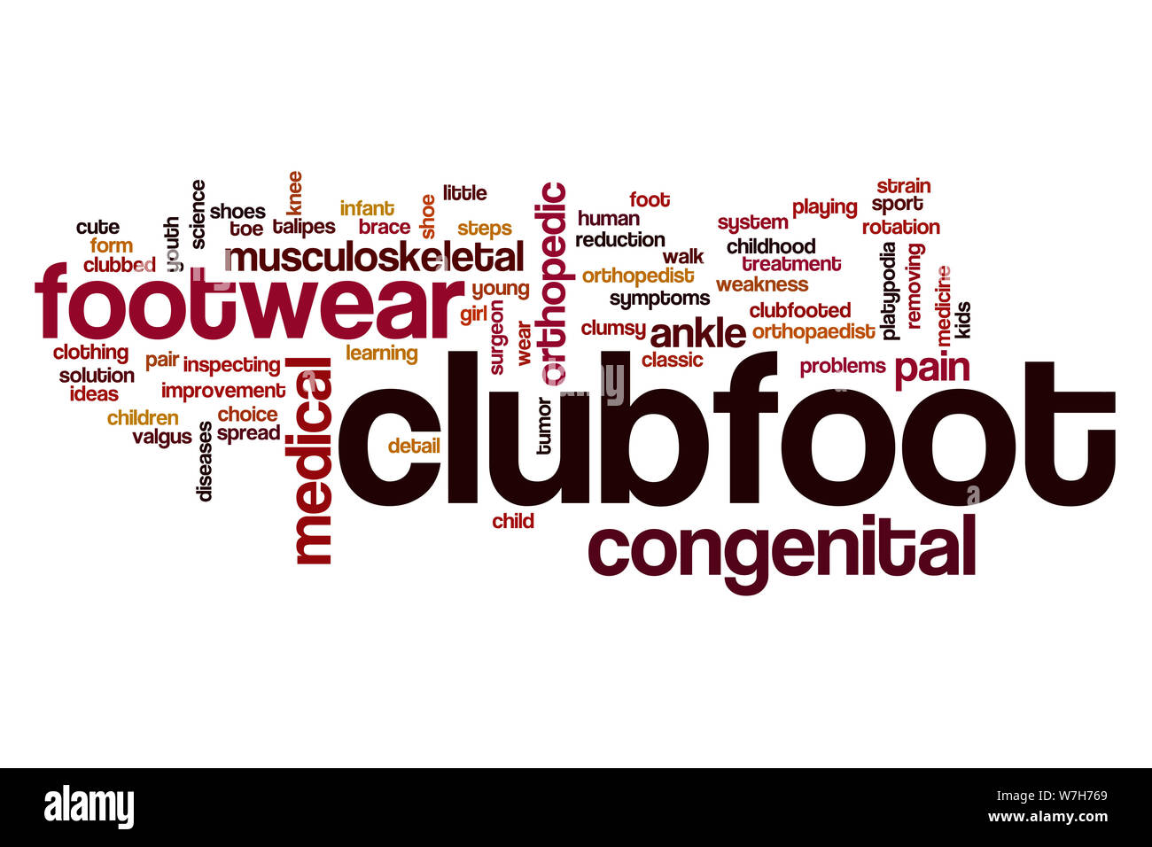 Clubfoot hi-res stock photography and images - Alamy