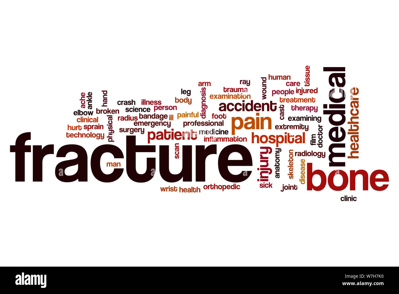 Fracture diagnosis Cut Out Stock Images & Pictures - Alamy