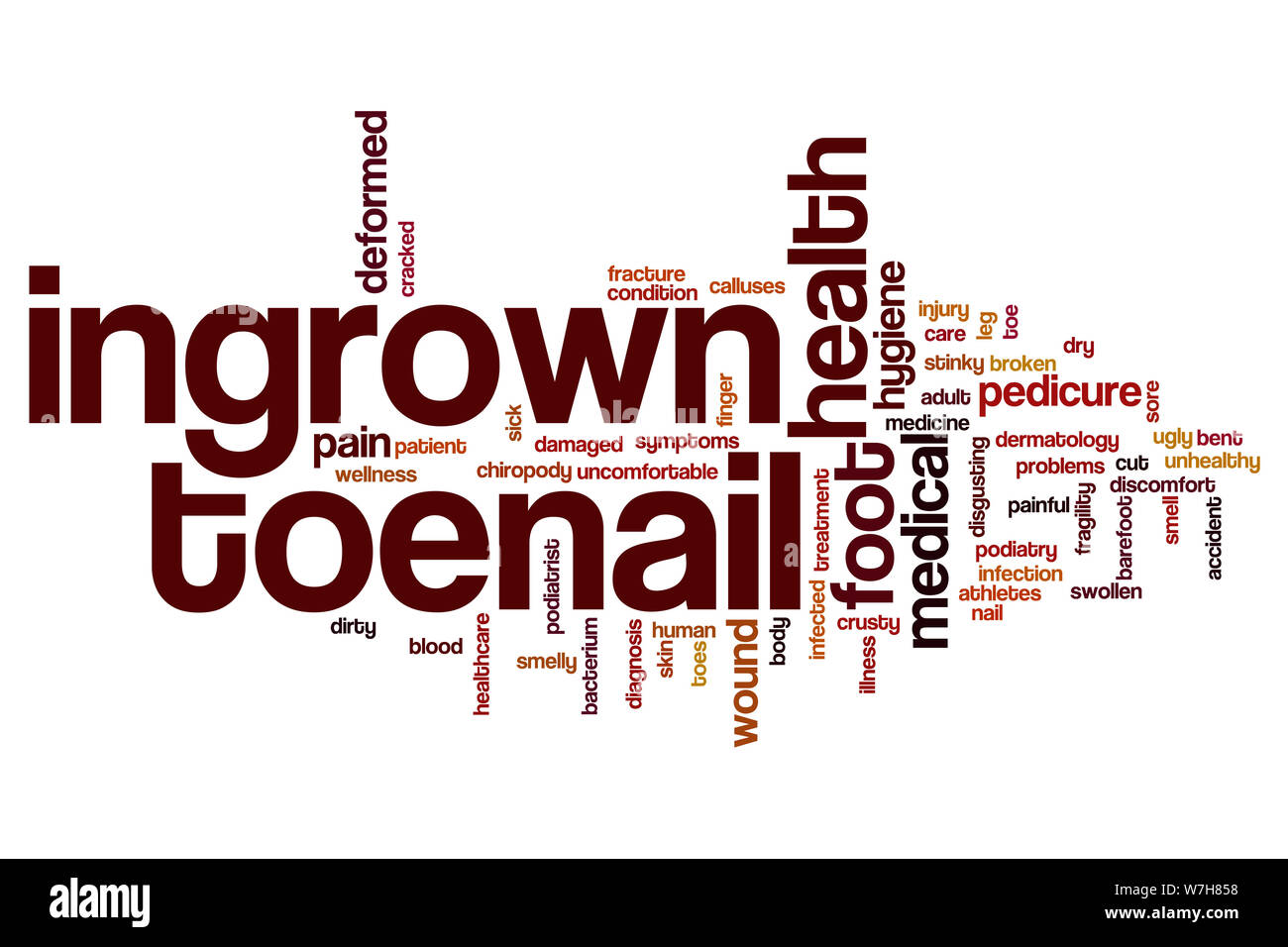 Ingrown toenail word cloud concept Stock Photo - Alamy