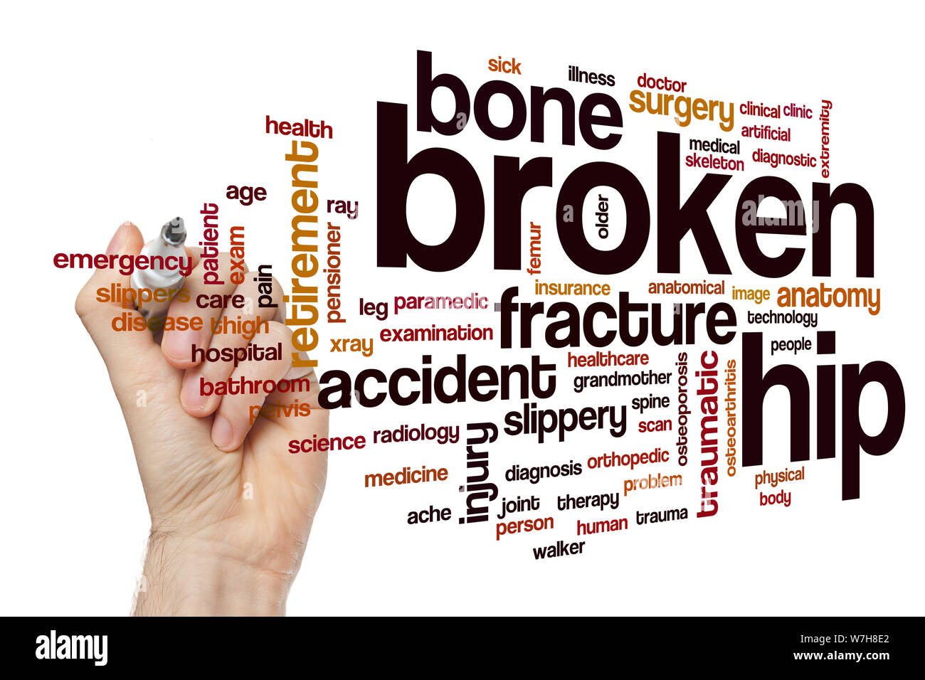Broken hip word cloud concept Stock Photo - Alamy
