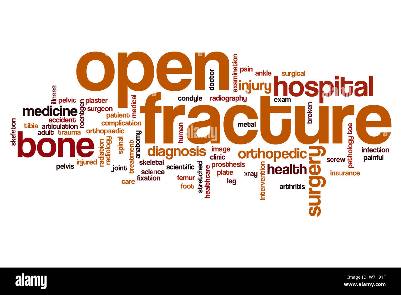 Open fracture hi-res stock photography and images - Alamy