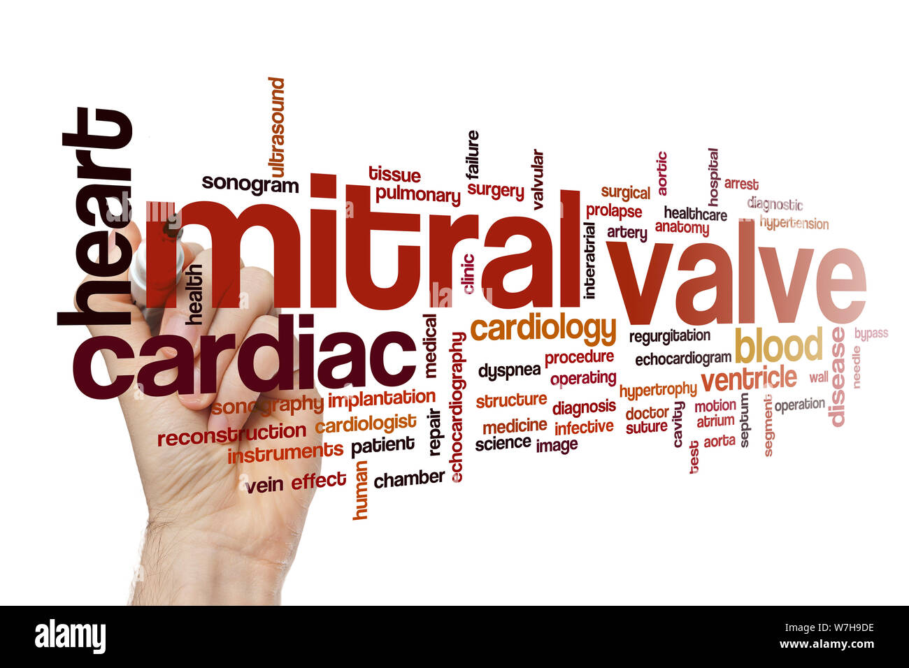 Mitral valve word cloud Stock Photo - Alamy