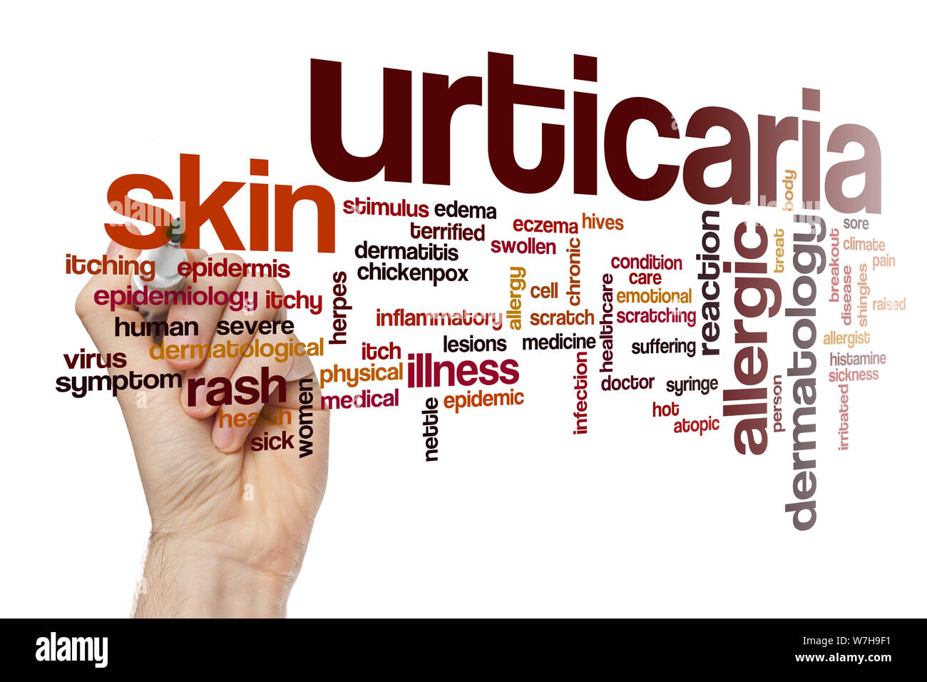 Urticaria word cloud Stock Photo - Alamy
