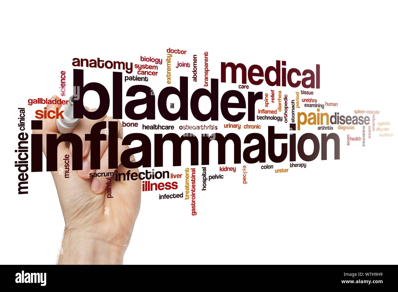 Bladder inflammation Cut Out Stock Images & Pictures - Alamy