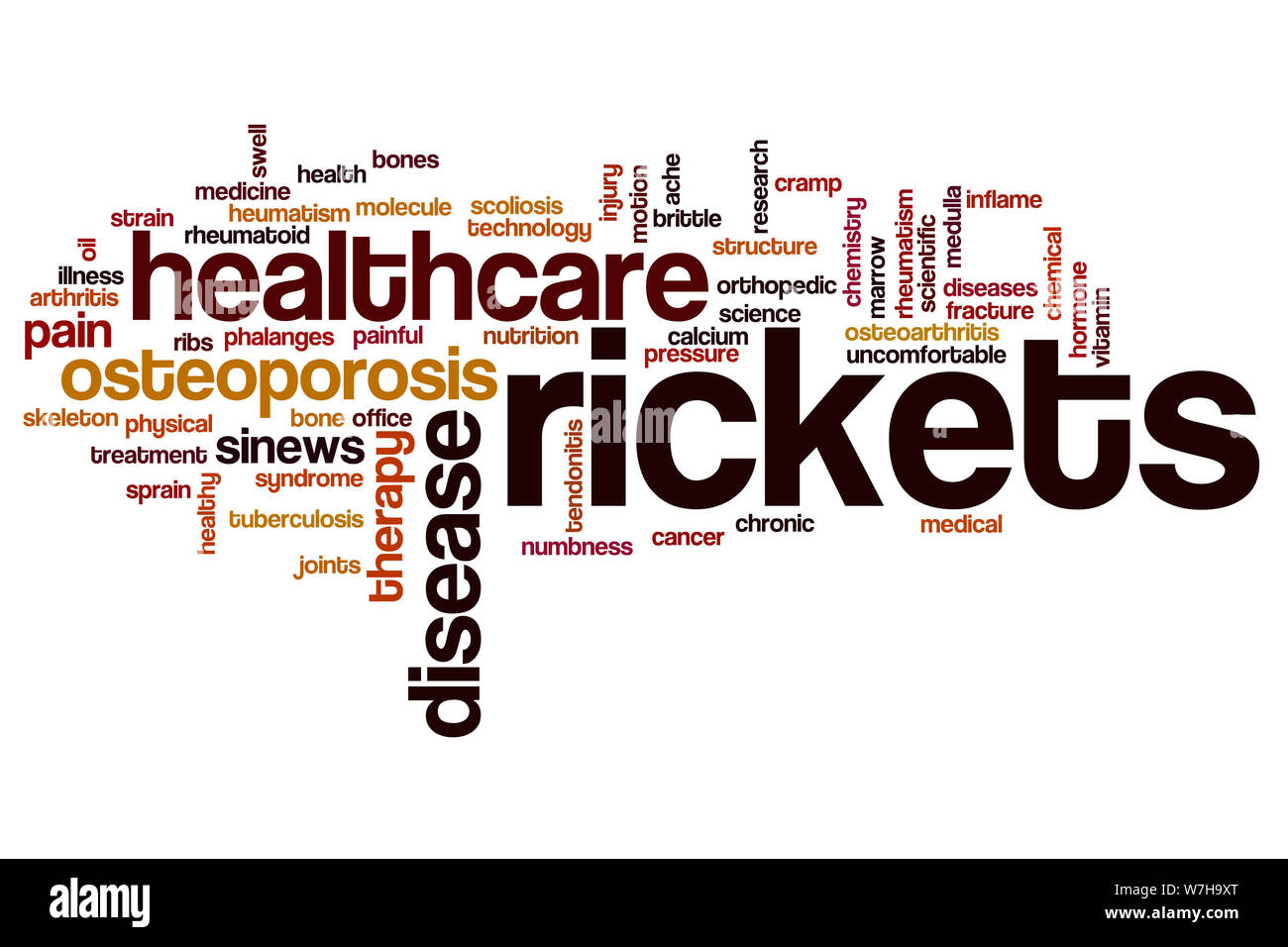 Rickets hi-res stock photography and images - Alamy