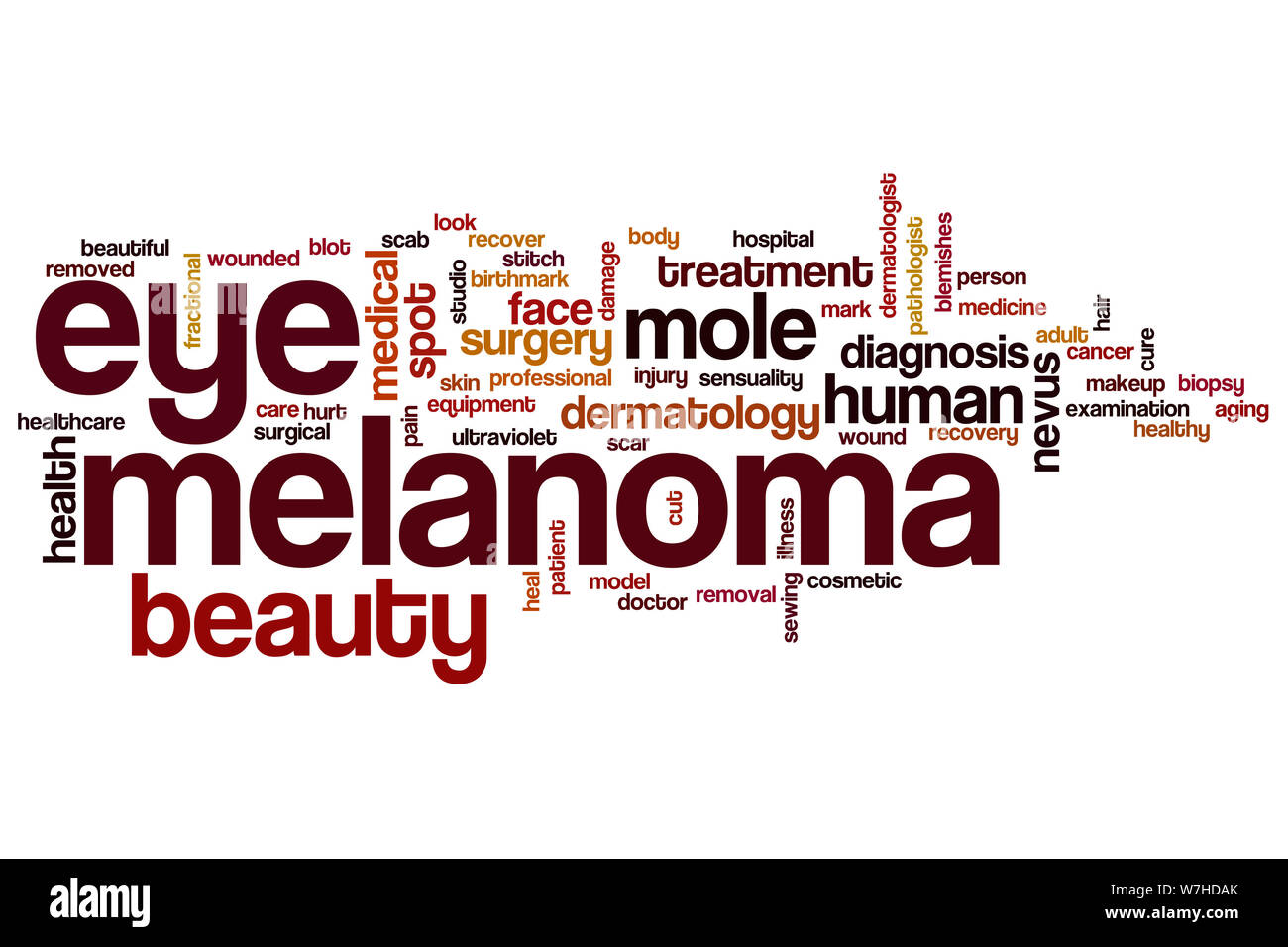 Eye melanoma word cloud concept Stock Photo - Alamy
