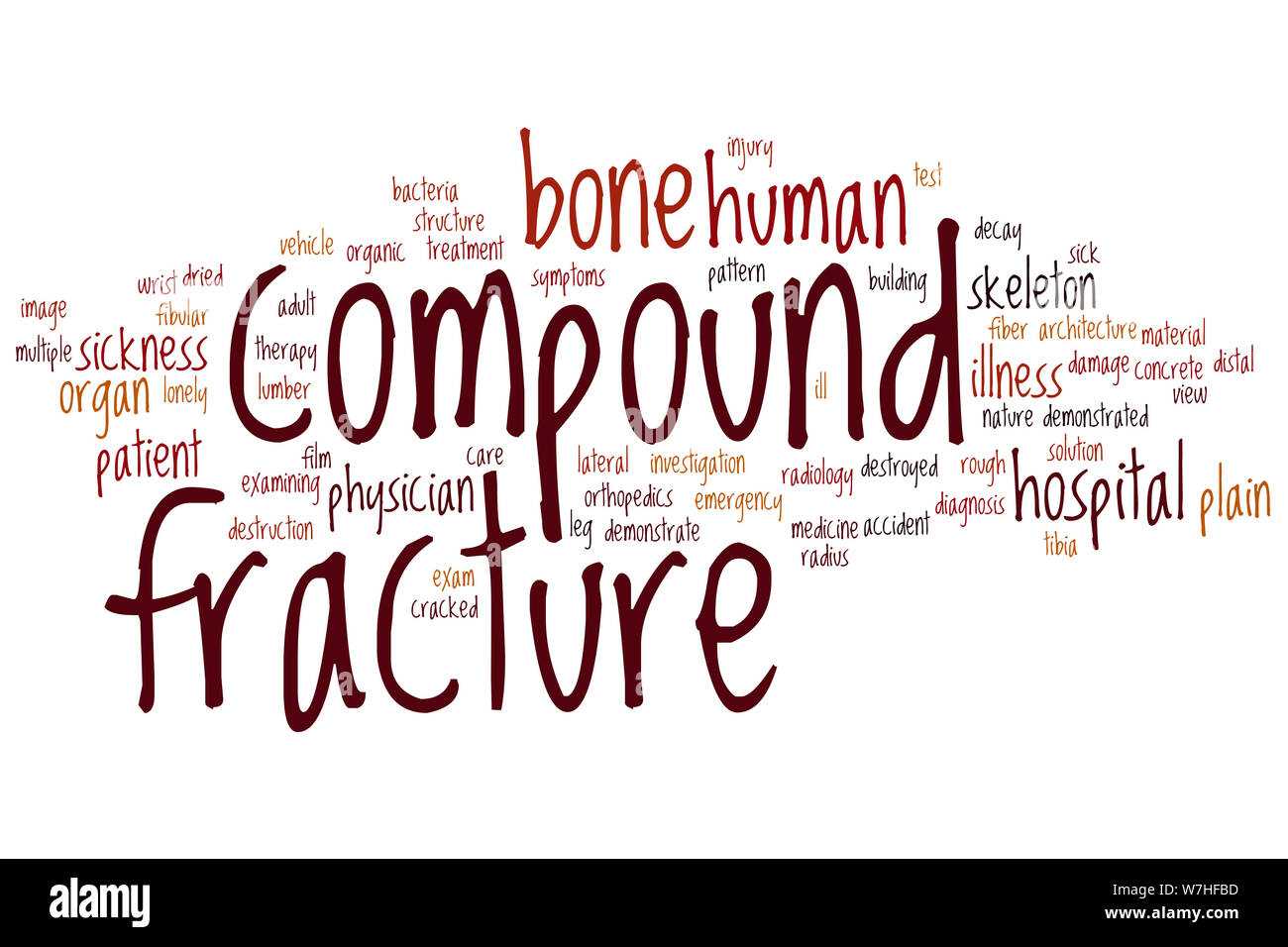 Compound fracture hi-res stock photography and images - Alamy