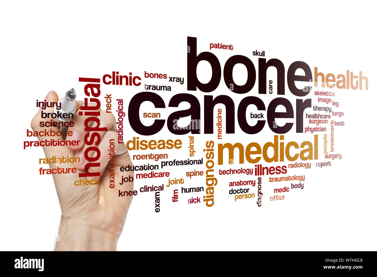 Bone cancer word cloud concept Stock Photo - Alamy