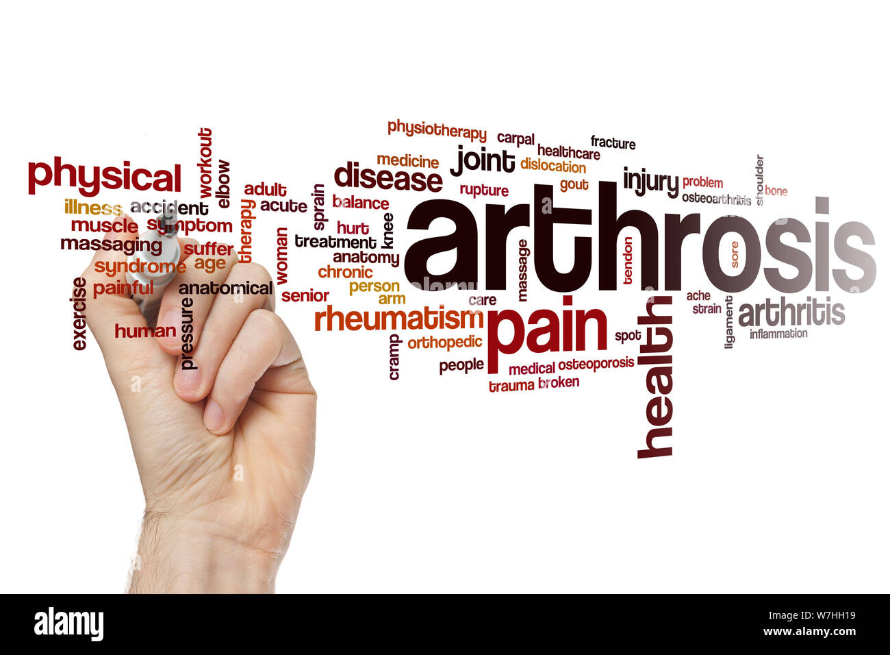 Elbow joint dislocation Cut Out Stock Images & Pictures - Alamy