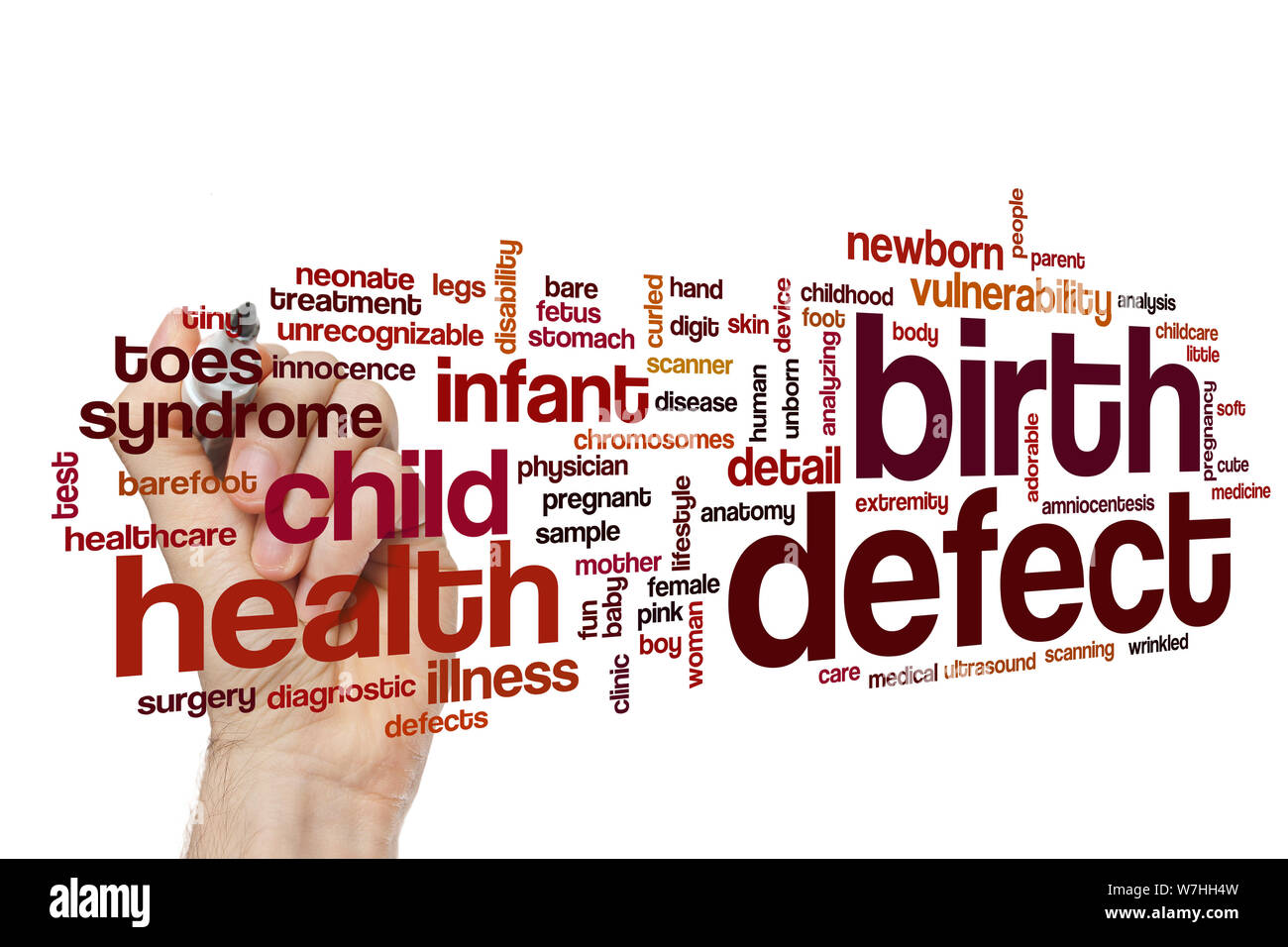 Birth defect word cloud concept Stock Photo - Alamy